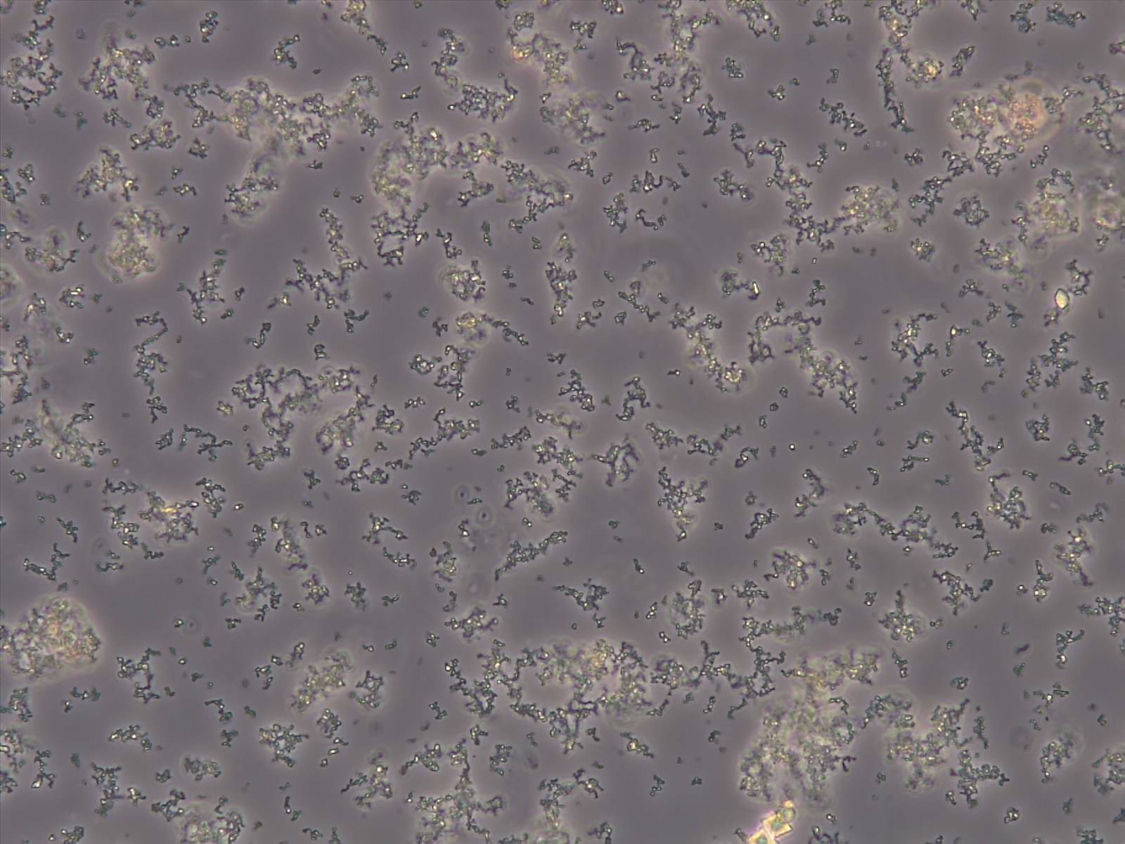 Amorphous precipitation | CellWiki